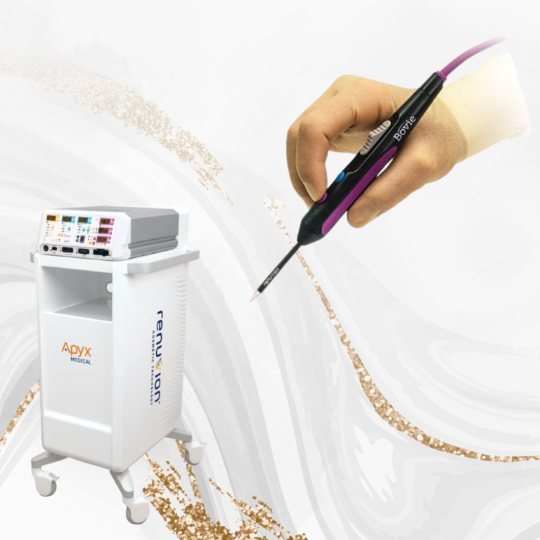 Renuvion – tehnologija sadašnjosti i budućnosti u zatezanju kože - Estetic